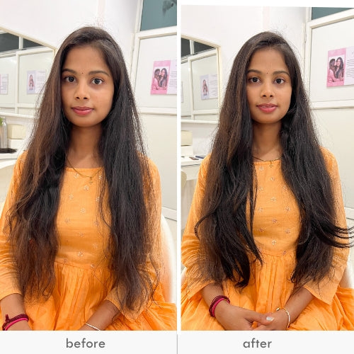 3-Set Clip-in Volumisers For Women - 1 Hair Stop International