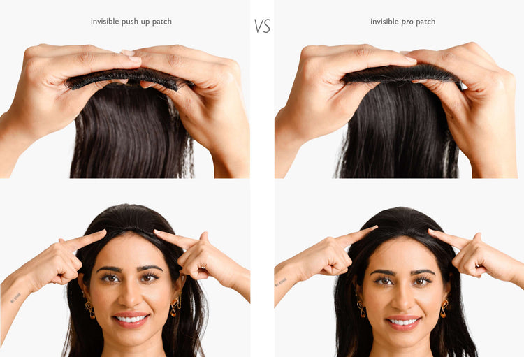 3x2'' Invisible Pro Hair Patch | Frontal Thinning Solution | 1hs – 1 ...